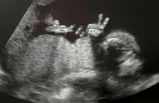 The Greystones Guide | Ovaries Before Rosaries